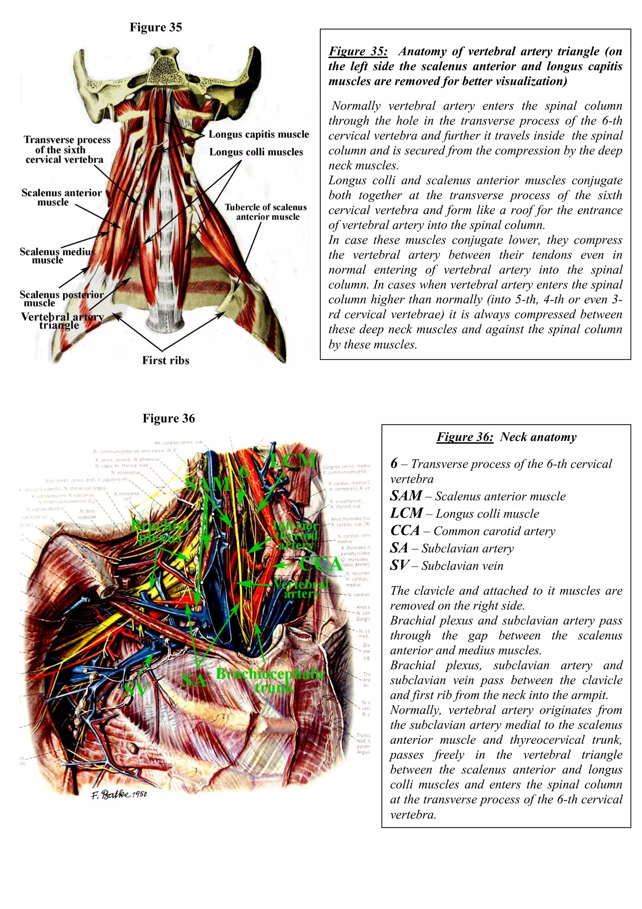 Cerebrovascular Disease, Cerebrovascular Insufficiency, Vertebrobasilar ...