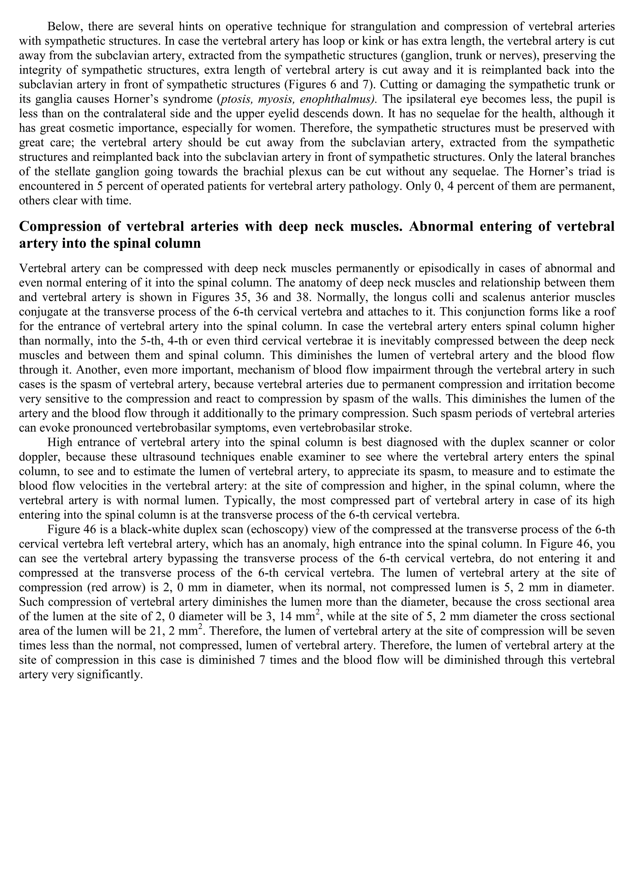 Cerebrovascular Disease, Cerebrovascular Insufficiency, Vertebrobasilar ...