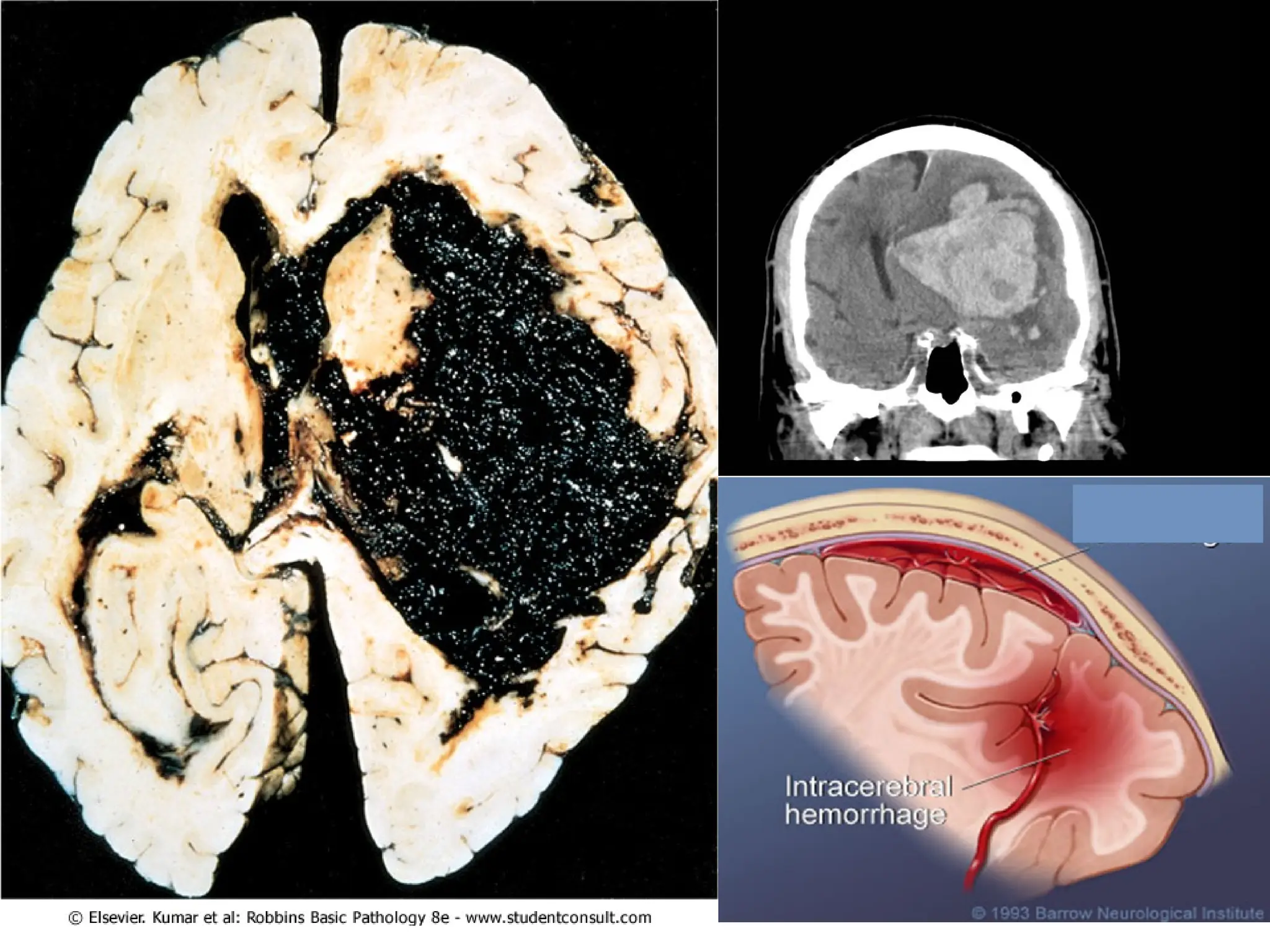 Cerebrovascular diseases and CNS trauma.pptx