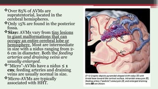 Imaging in Cerebrovascular Malformations | PPT
