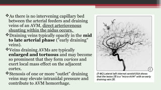 Imaging in Cerebrovascular Malformations | PPT