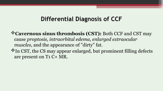 Imaging in Cerebrovascular Malformations | PPT