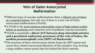 Imaging in Cerebrovascular Malformations | PPT