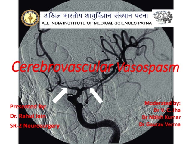 Cerebrovascular Vasospasm - Etiopathogenesis and Management | PPTX | Blood Disorders | Diseases ...