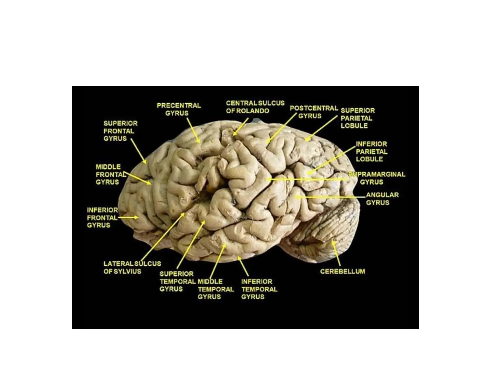 CEREBRUM-2.pptx