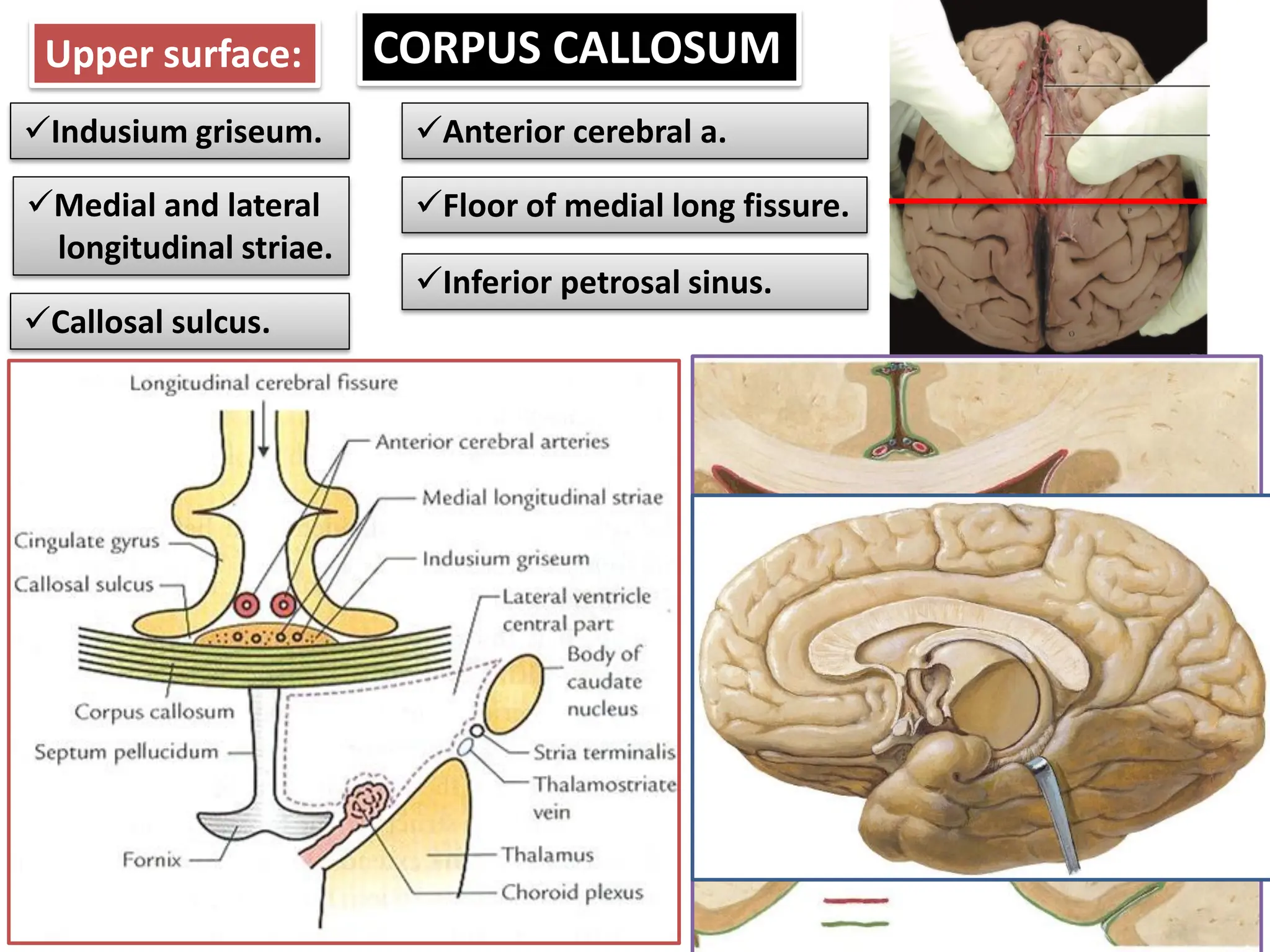 Cerebrum and sulcus and gyri and their functional areas | PDF