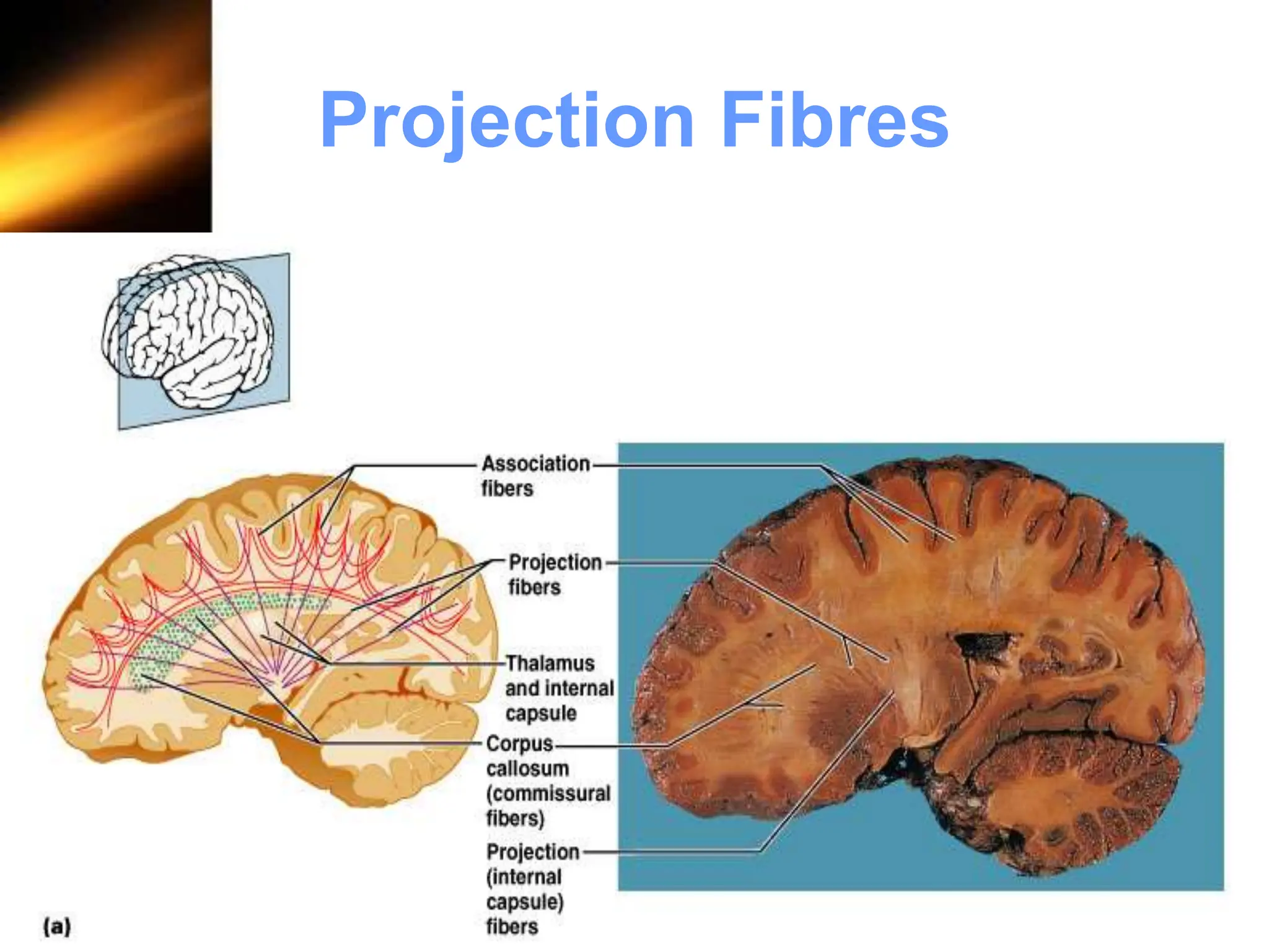 Cerebrum_Internzzzzzzzzzzzzal Structure.ppt