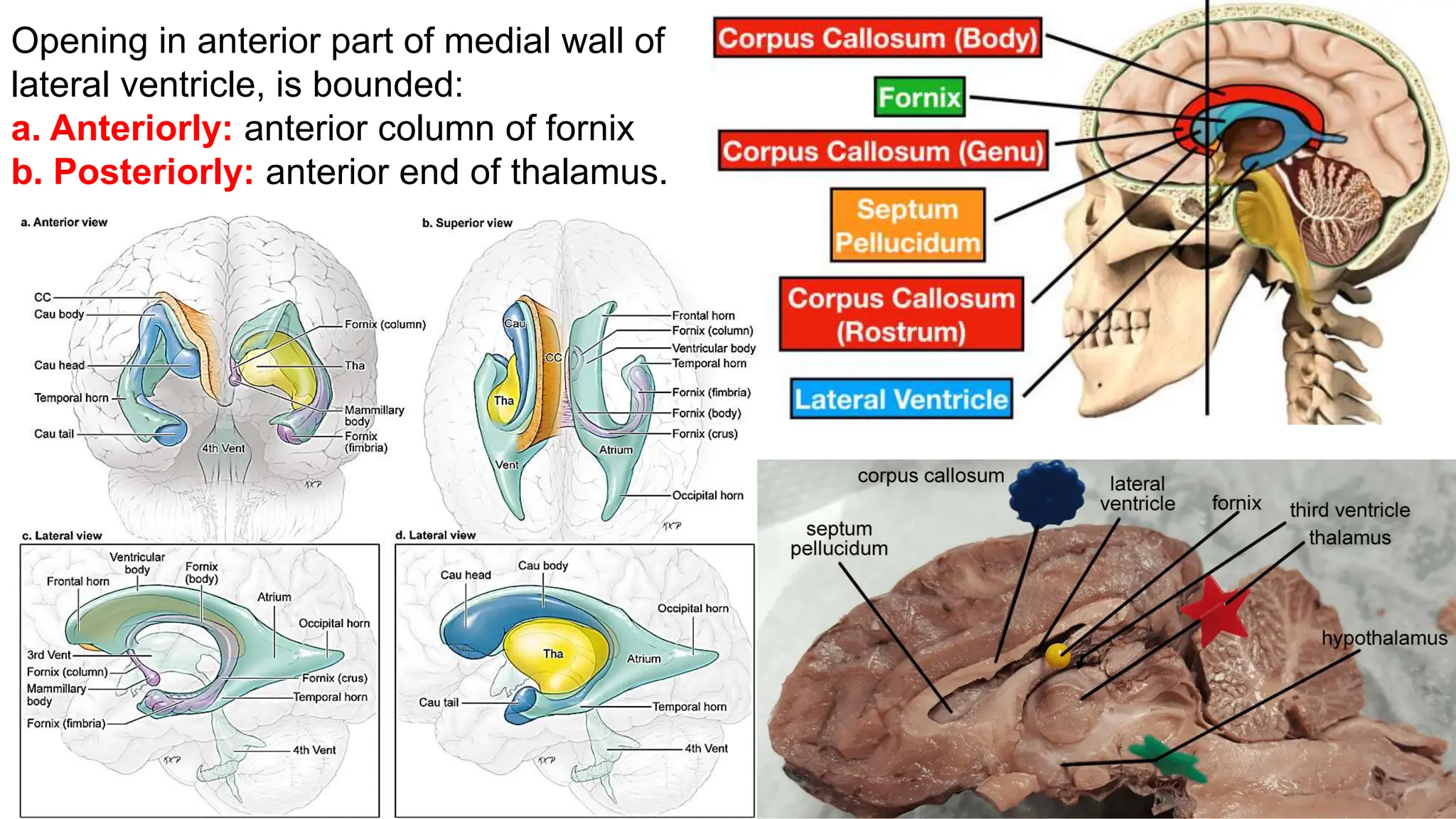 Cerebrum & White Matter and Clinical Correlations.pptx