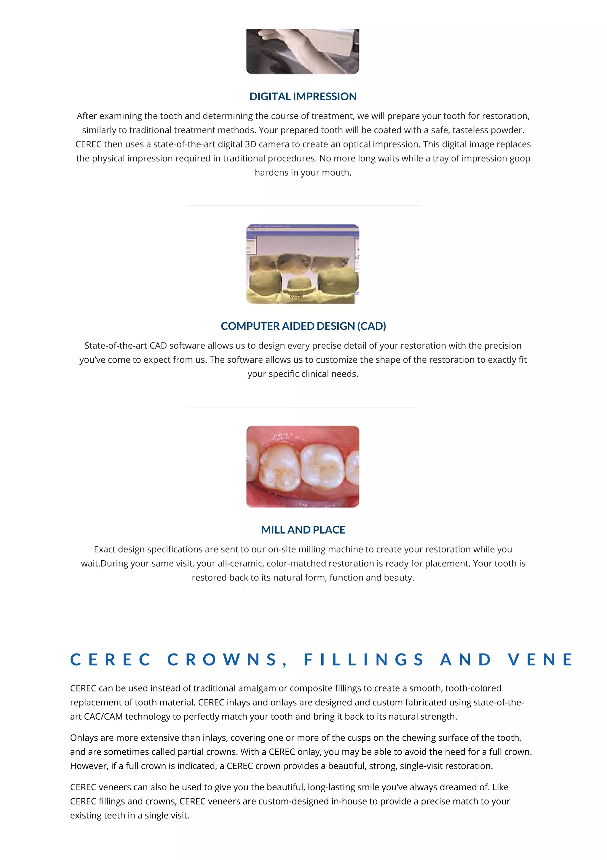 Cerec crowns | PDF