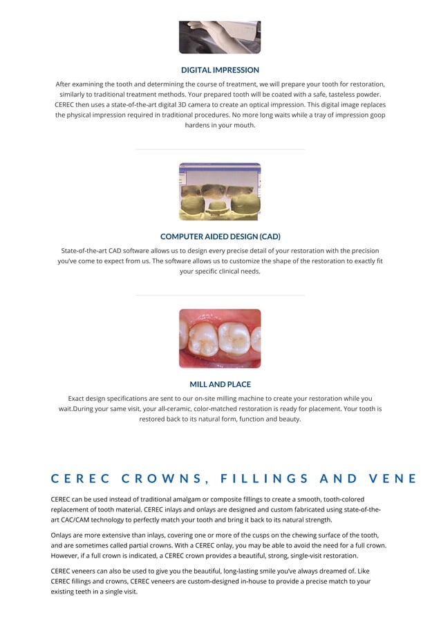 Cerec crowns | PDF