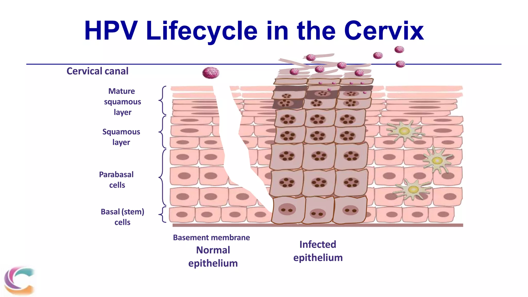 Cervavac : A silver bullet for protection against cervical cancer : Dr ...
