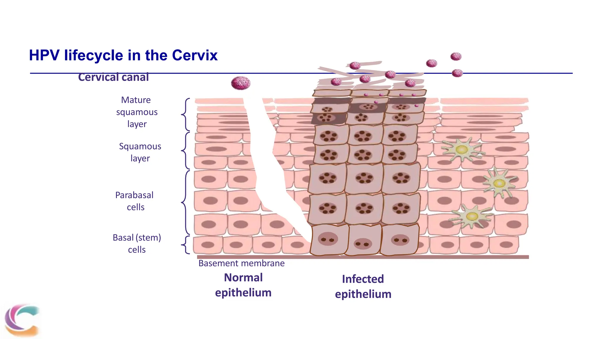 Cervavac_Speaker_Set_1.pptx
