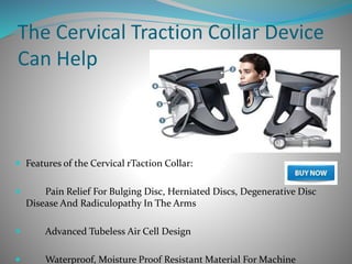 Cervical | PPTX
