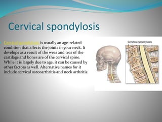 Cervical | PPTX