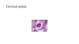 Cervical-anatomy biomechanics and bathomechanics | PDF