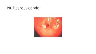 Cervical-anatomy biomechanics and bathomechanics | PDF