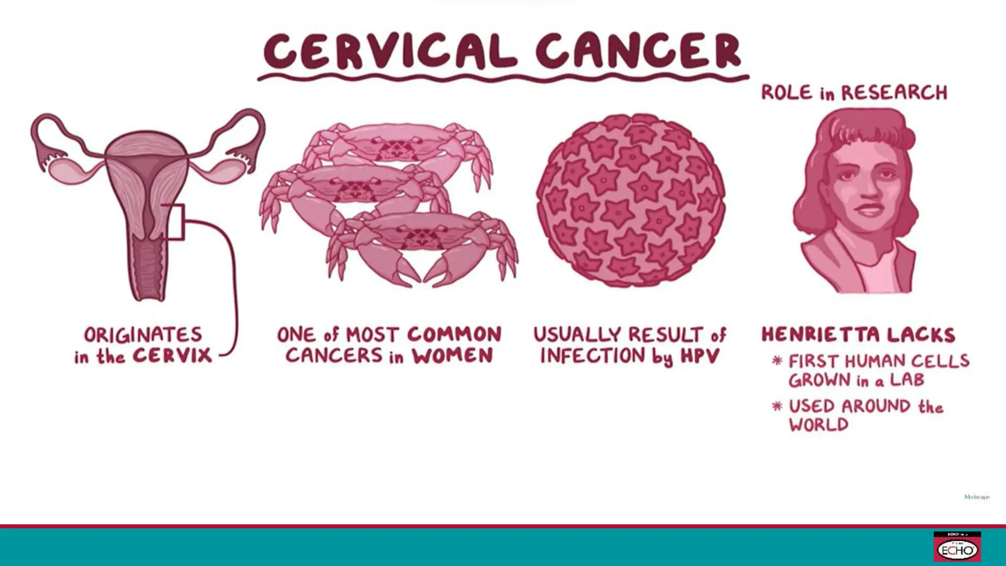 CERVICAL-CANCER-introduction, screening and prevention | PPTX