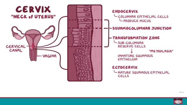 CERVICAL-CANCER-introduction, screening and prevention | PPTX