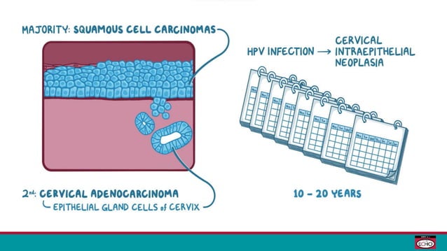 CERVICAL-CANCER-introduction, screening and prevention | PPTX