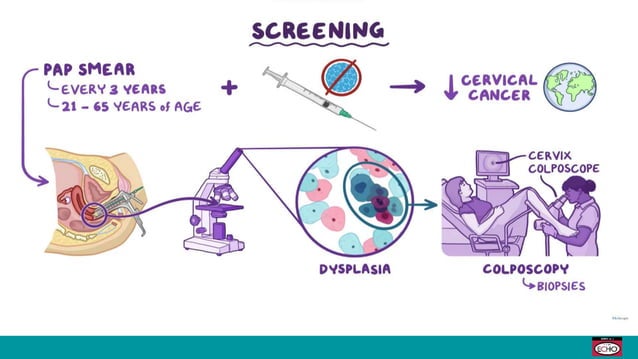 CERVICAL-CANCER-introduction, screening and prevention | PPTX