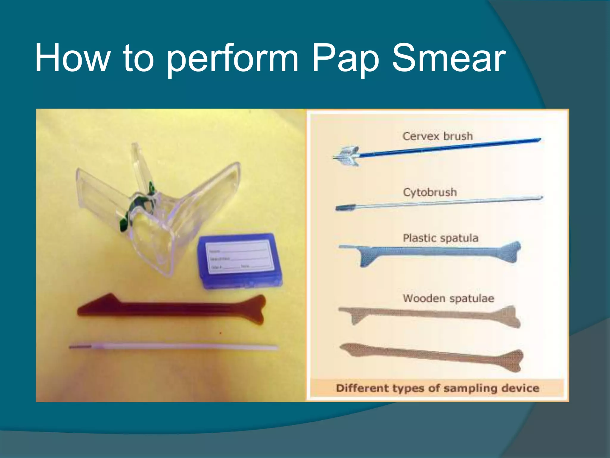 Cervical cancer screening modalities | PPTX