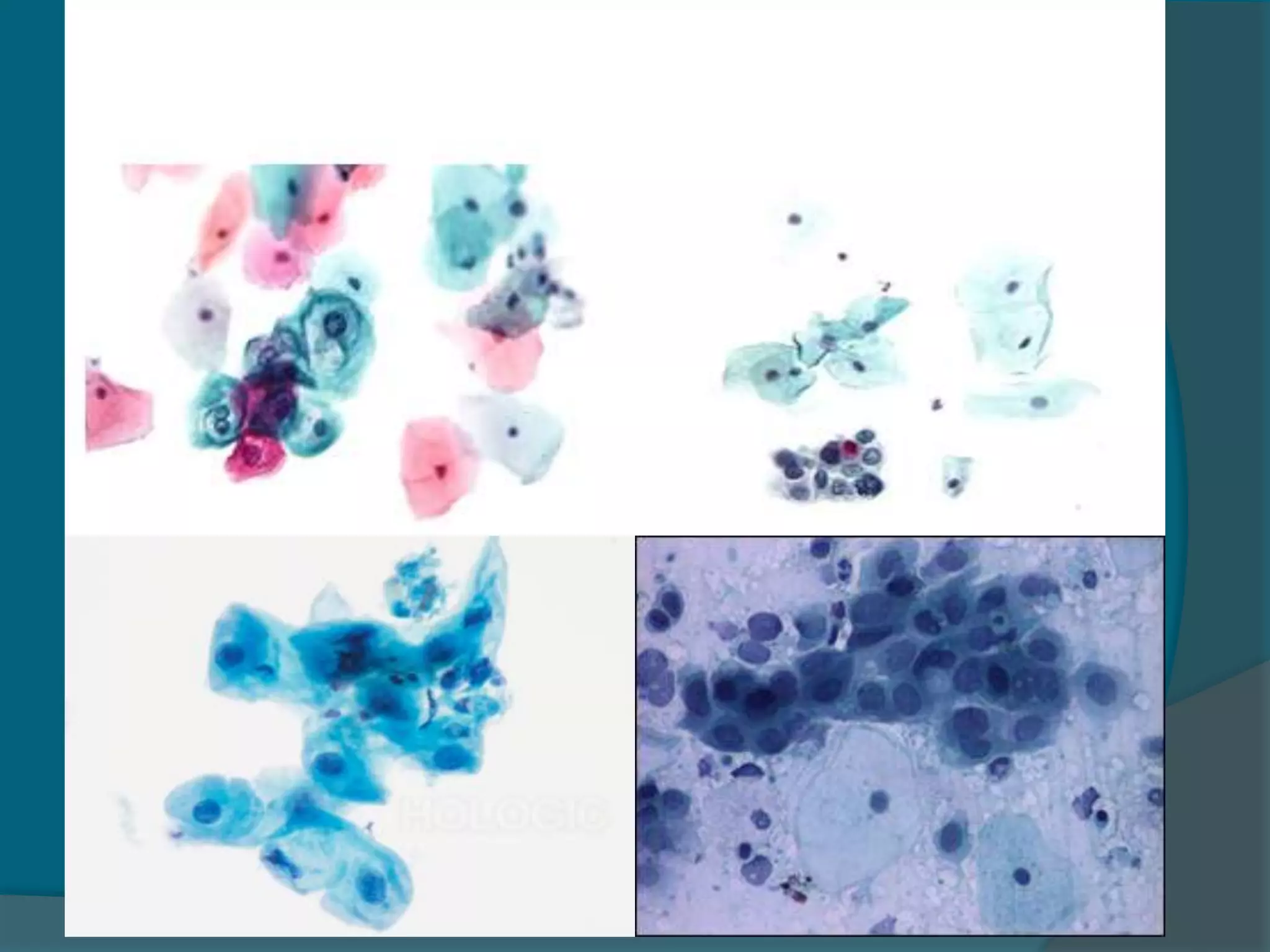 Cervical cancer screening modalities | PPTX