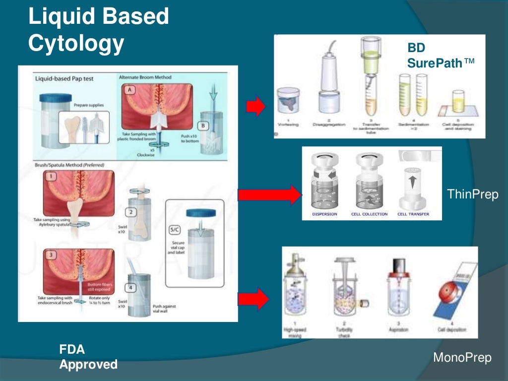 Cervical cancer screening modalities