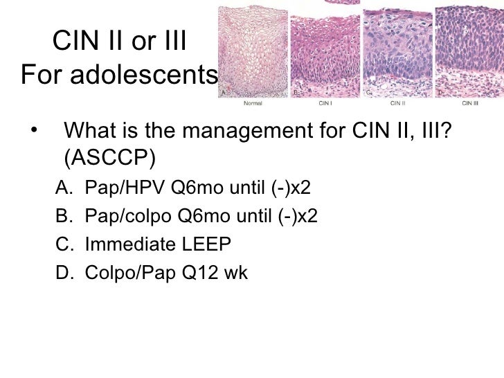 Cervical Cancer Screening