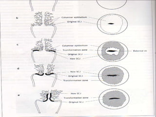 Cervical anatomy & pathology | PPTX