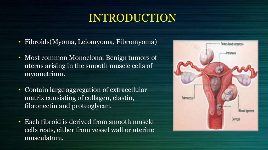 Cervical and broad ligament fibroid