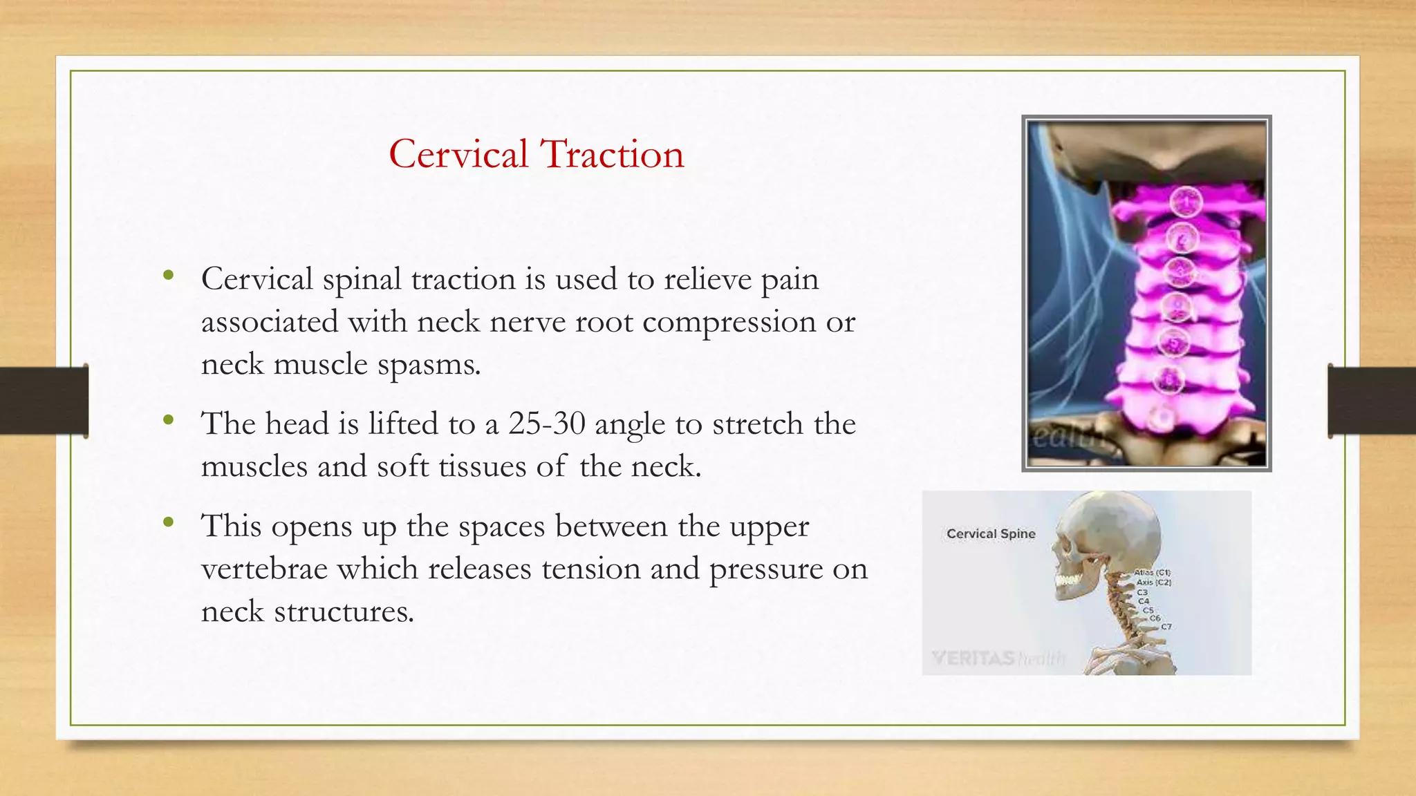 Cervical and Lumbar Traction | PPTX