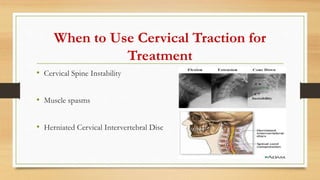 Cervical and Lumbar Traction | PPTX