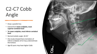 Cervical angle about line in cervical based on a journal i found.pptx