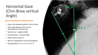 Cervical angle about line in cervical based on a journal i found.pptx