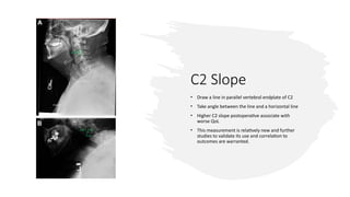 Cervical angle about line in cervical based on a journal i found.pptx