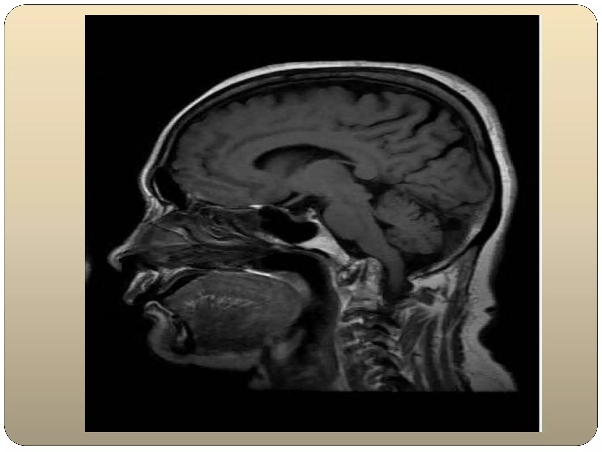 Congenital anomalies and Normal skeletal variants- Cervical spine | PPT