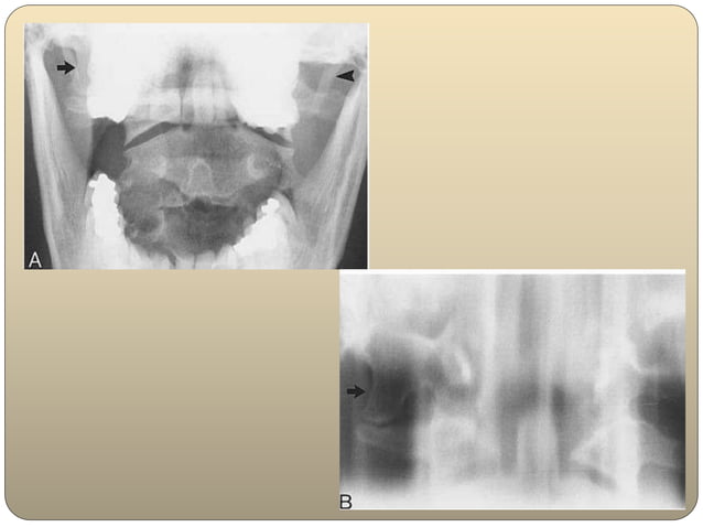 Congenital anomalies and Normal skeletal variants- Cervical spine | PPT