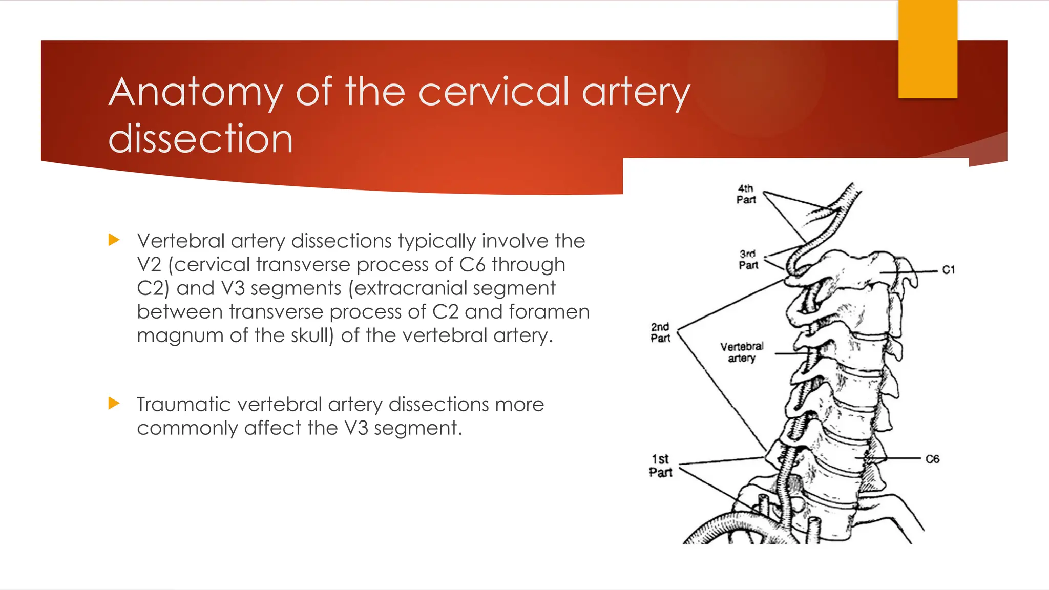 Cervical arterial dissection GCH 04-20-2023.pptx