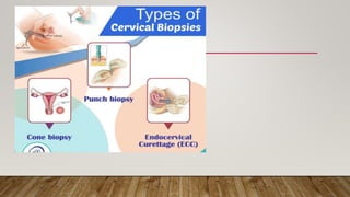 Cervical biopsy procedure | PPTX