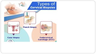 cervical biopsy procedure.pptx