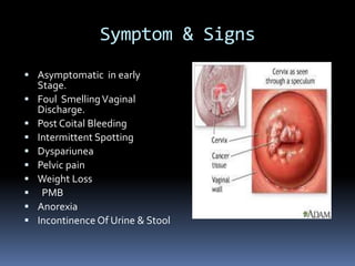 Cervical cancer | PPT