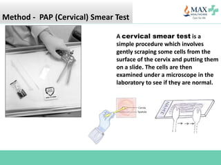 Cervical cancer - Role of screening and management of advanced stage ...