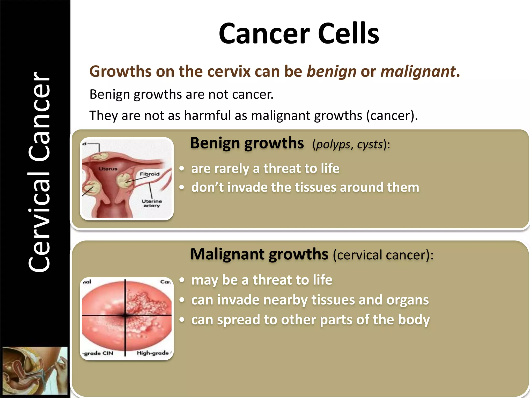 Cervical cancer | PPTX