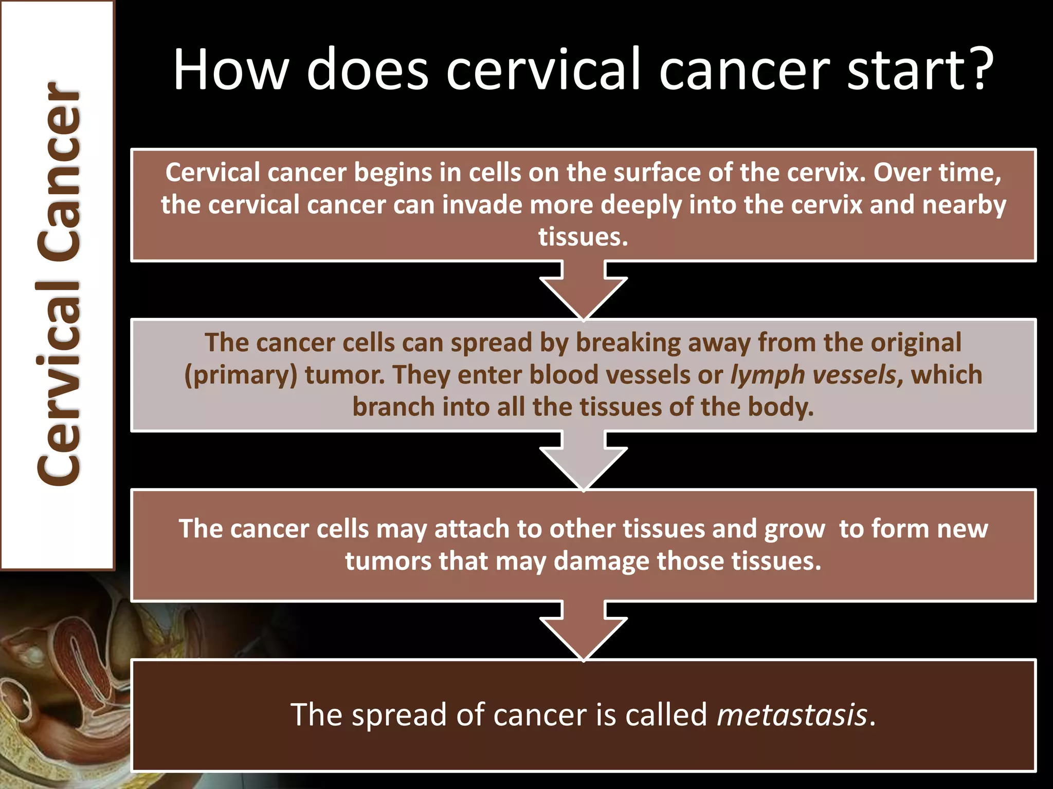 Cervical cancer | PPTX