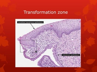Cervical cancer | PPT