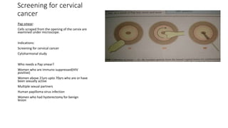 Cervical cancer | PPT