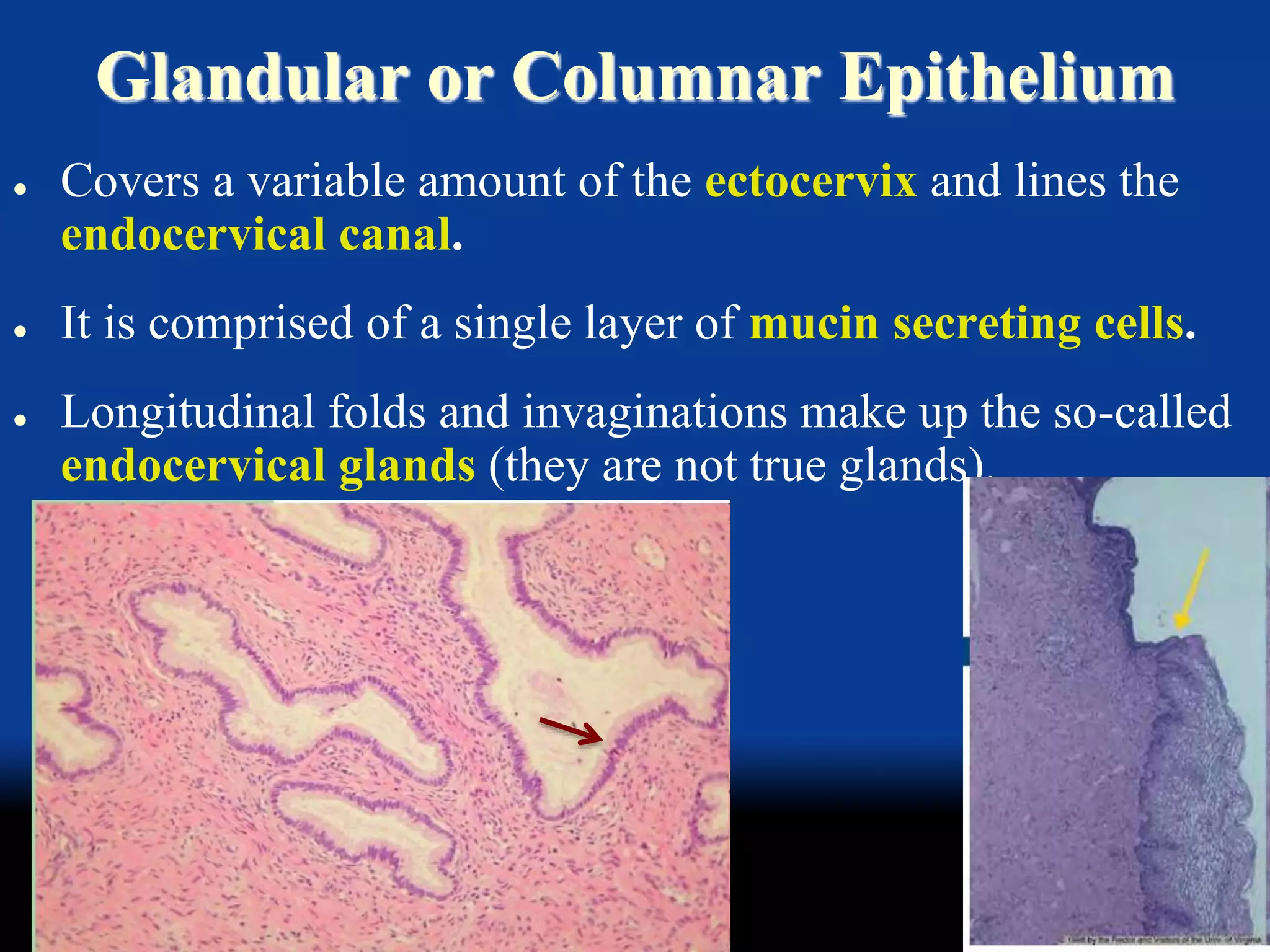 Cervical cancer | PPTX