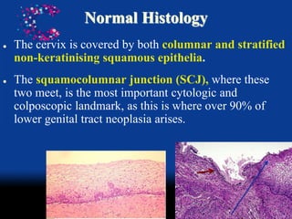 Cervical cancer | PPTX
