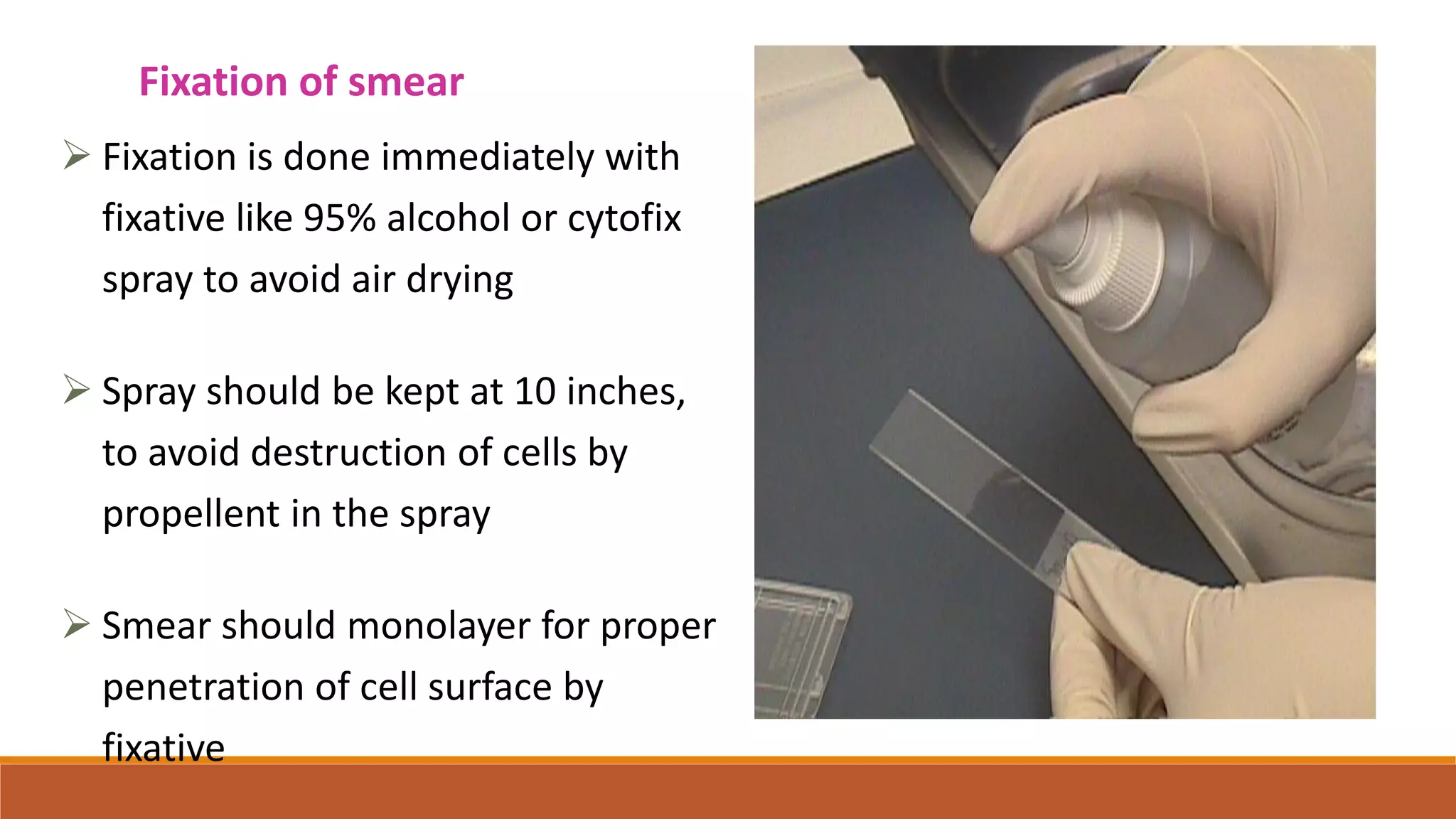 Cervical cancer | PDF