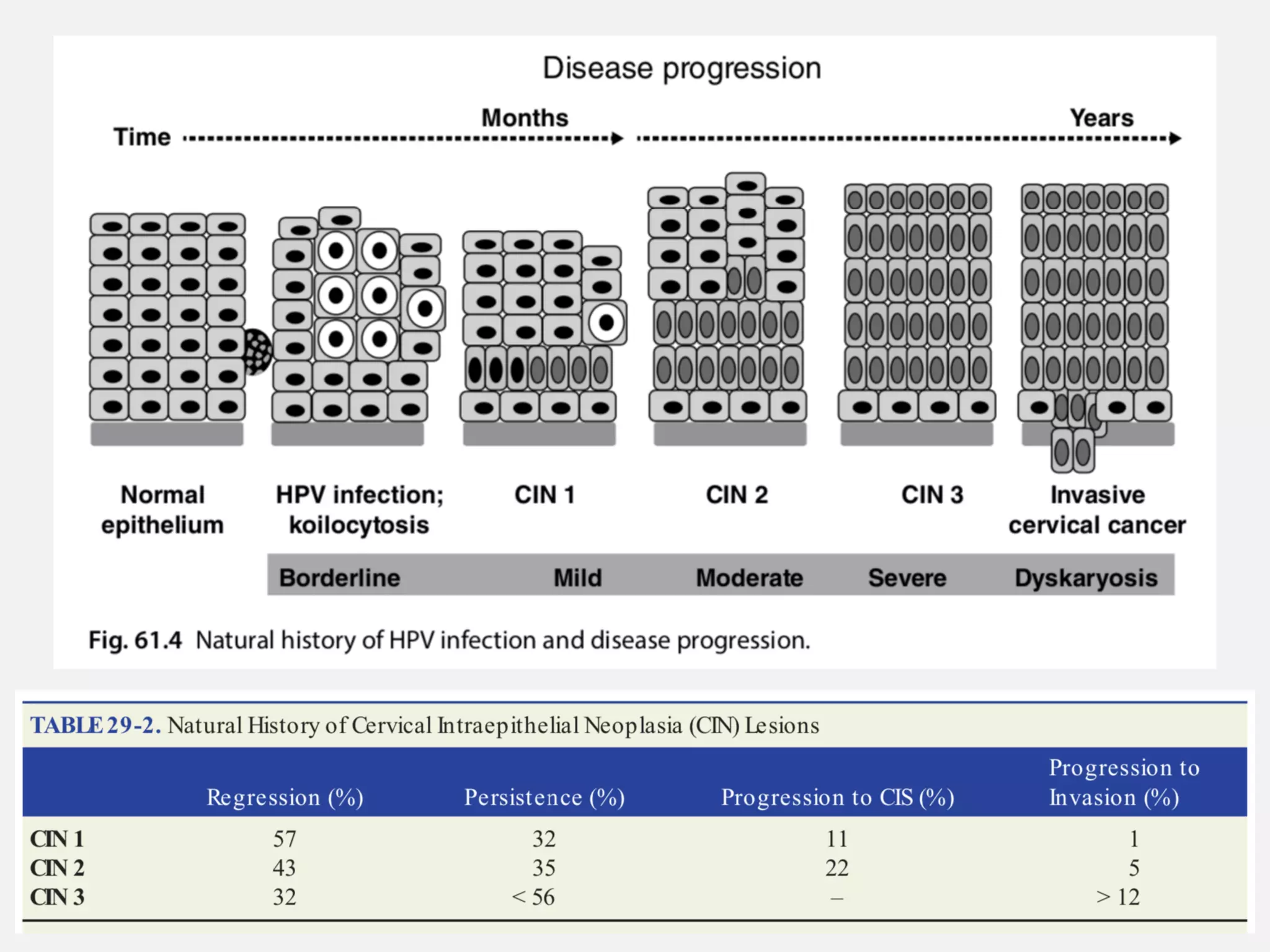 Cervical Neoplasia and Carcinoma | PDF